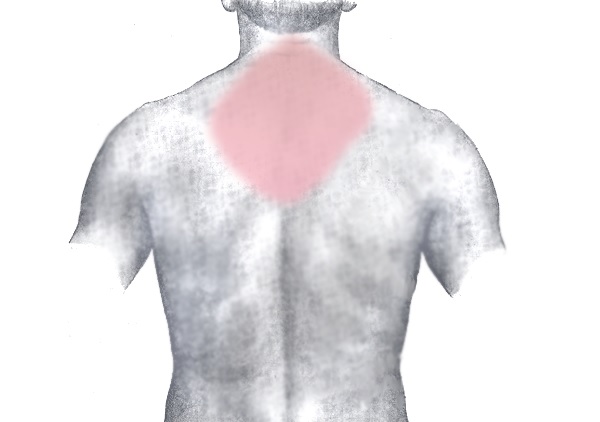 Bol između lopatica: mogući uzroci i kako tretirati bol (video ...