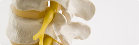 Deformacije kralježnice - kifoza i lordoza | Fitness.com.hr